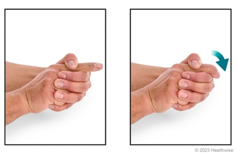 Isolated DIP-Joint Flexion | CommonSpirit Health